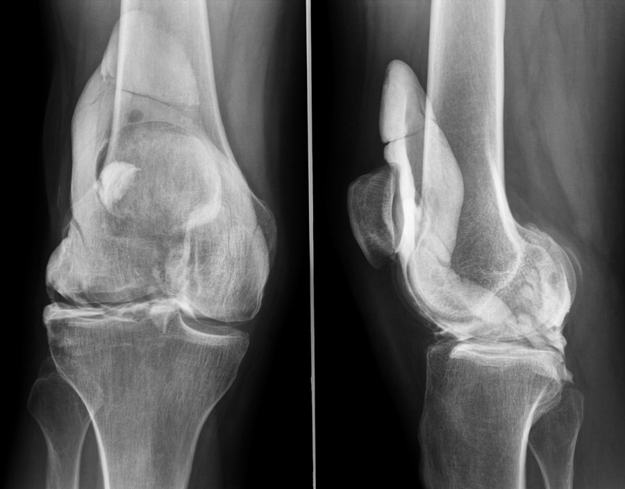 Radiologie Grenoble CIMG - Arthroscanner Radiologie Grenoble CIMG - Arthroscanner